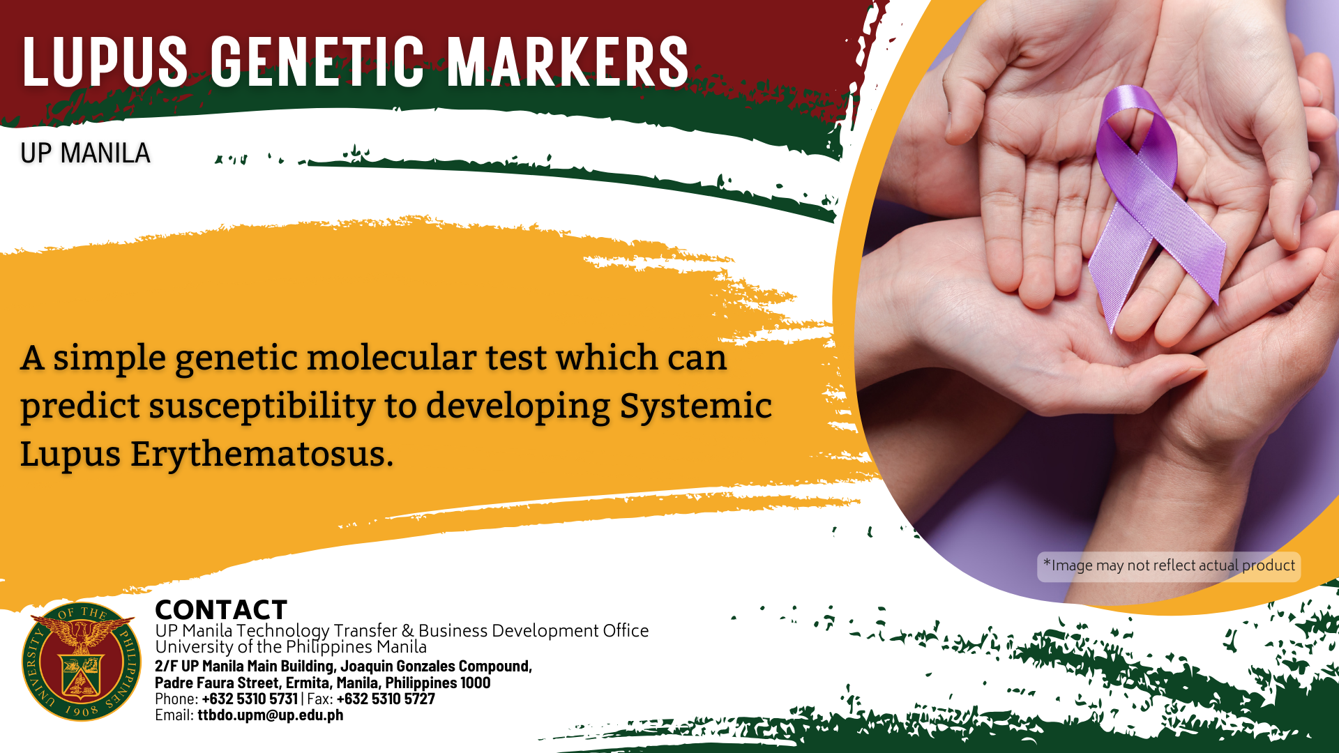 Lupus Genetic Markers – UP Manila TTBDO